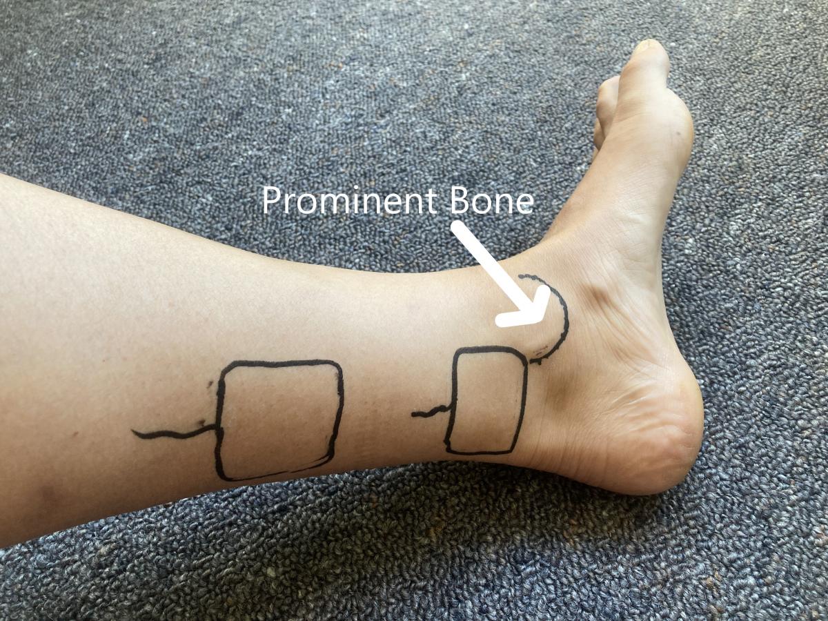 Posterior Tibial Nerve | Innerstrength Healthcare